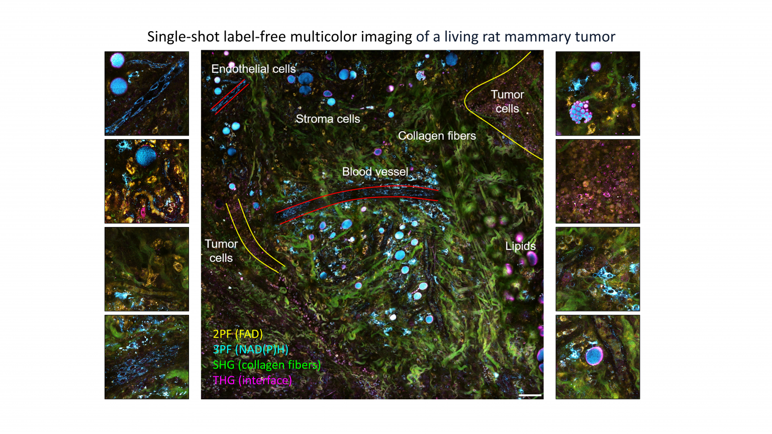 Computational Biophotonics Lab - Label-free multiphoton microscopy